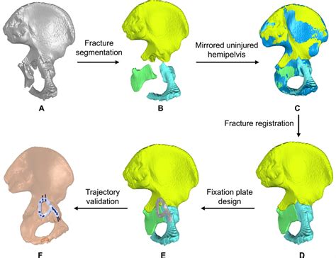 Comparison Of 2 Open Sourced 3 Dimensional Modeling Techniqu Ota