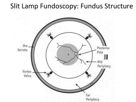 Slit Lamp Fundoscopy