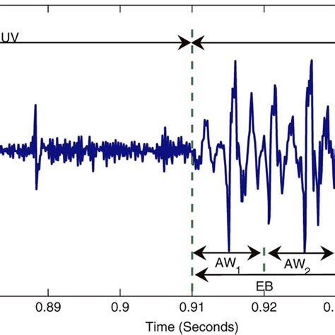 Part Of A Speech Signal Illustrating Partitioning For Pitch Based Data Download Scientific