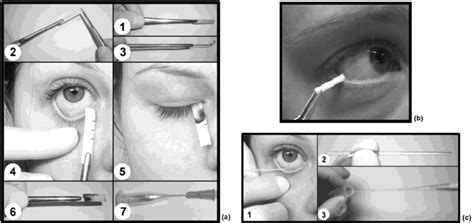 Tear Fluid Collection Methods A Sampling With Schirmers Test The