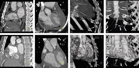 Au2013d First Computed Tomography Ct Scan With Multiplanar