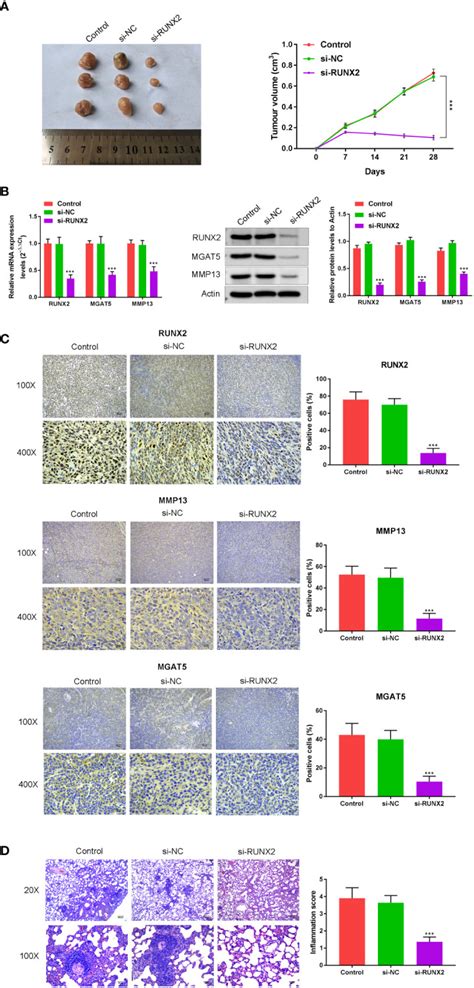 RUNX2 Promotes Gastric Cancer Progression Through The Transcriptional Activation Of MGAT5 And