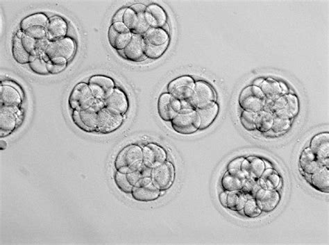 Frozen Embryo Transfer Perth FET Fertility North