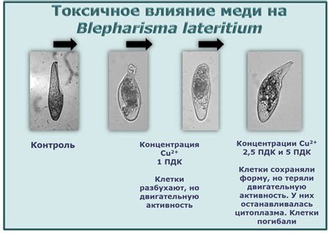 Blepharisma Lateritium