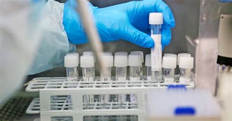 Identificaron El Gen De Una Nueva Enfermedad Que Afecta Al Sistema