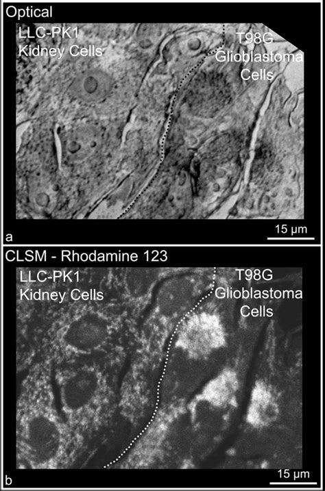 Correlative Reflected Light Microscopy A And Clsm Fluorescence