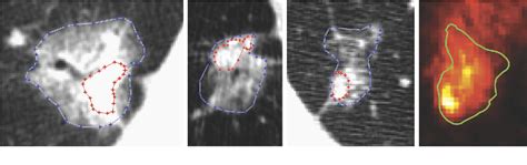 figure 12 1 from quantimage an online tool for high throughput 3d