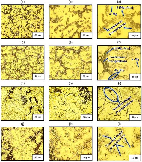 The Optical Microstructure Of Az91 Alloy In A 50 µm B 20 µm C 10 µm