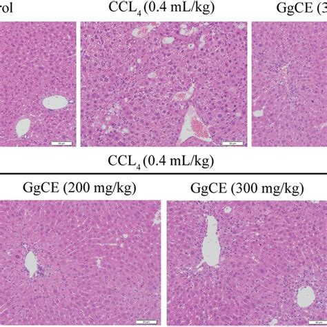 Ggce Improved Ccl4 Induced Oxidative Damage In Mice Liver Chronic