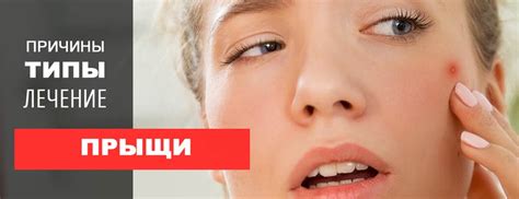 Причины и лечение мелких прыщей на коже для безупречного внешнего вида