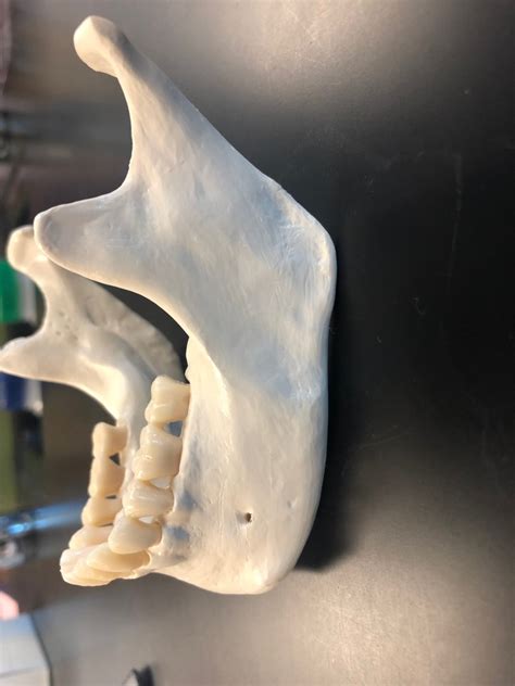 Mandible Diagram Quizlet