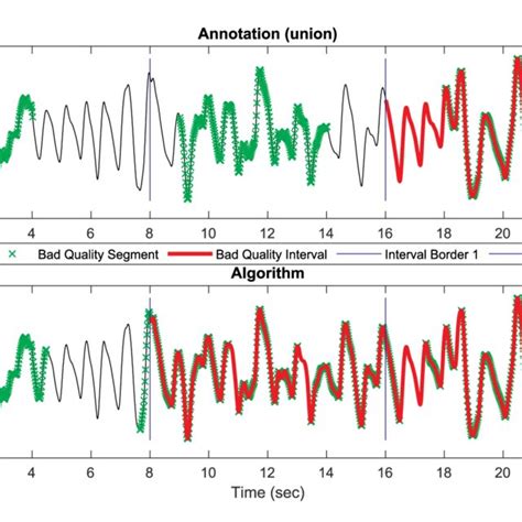 The Preprocessed Filtering And Peak Detection Ppg With The Following