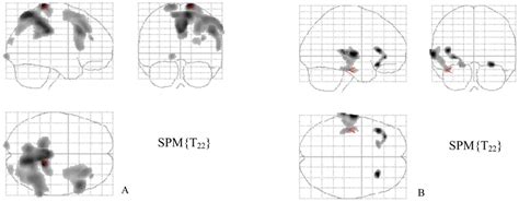 Statistical Parametric Maps Displaying Correlations Between Cerebral