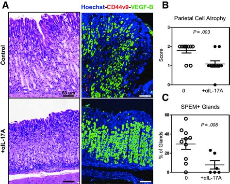 Neutralizing Il 17a Reduces Parietal Cell Atrophy And Spem Txa23 Mice Download Scientific