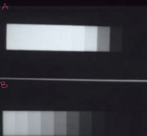 Digital Radiography Flashcards Quizlet