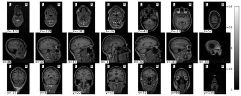 Working With Nifti Images — Neural Data Science In Python