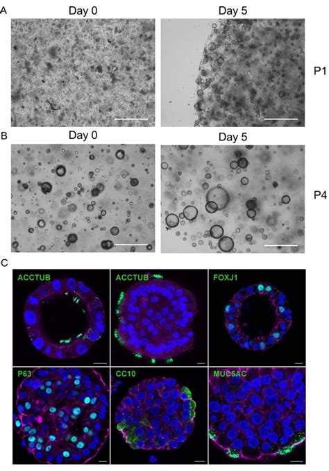 Establishing Human Lung Organoids And Proximal Differentiation To
