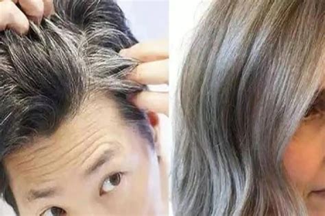 White Hair Problem Why Hair Turn Grey At A Young Age Know Treatment