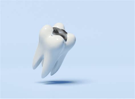 What Are The Causes Of Black Lines On Teeth Molars A Guide