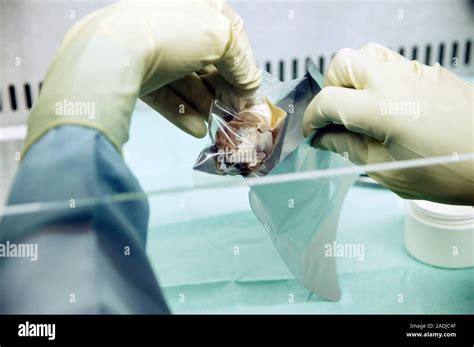 Preparing A Dissected Aortic Valve For Storage In A Tissue Bank The