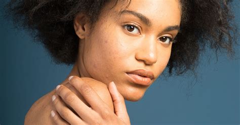 Maple Extract Is The Best New Anti Aging Ingredient