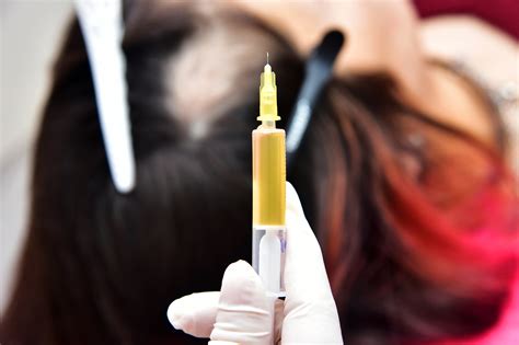 Steroid Injections For Hair Loss Effectiveness Risks And Benefits