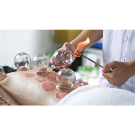 Udemy Course Professional Fire Cupping Therapy Course Certificate By