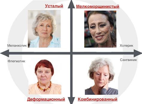 Типы старения лица особенности изменений каждого типа и их