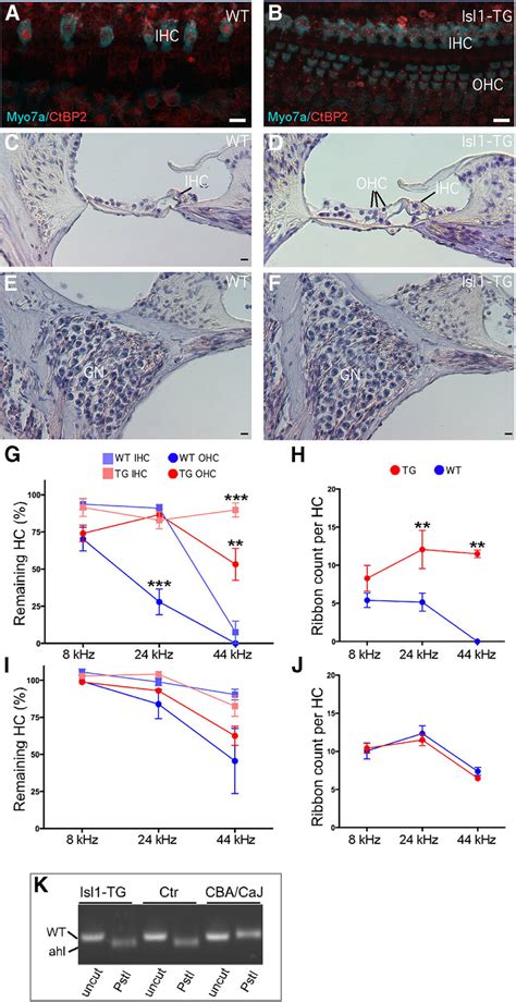 Survival Of Hair Cells And Preservation Of Presynaptic Ribbons In Aged