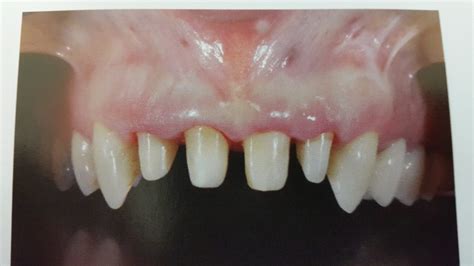 Dental Prosthetic Services Rustenburg Dental Centre