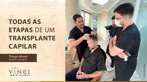 CONFIRA TODAS AS ETAPAS DE UM TRANSPLANTE CAPILAR YouTube