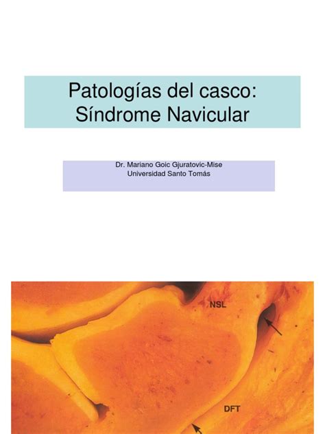 Sme Patologías Del Casco Sindrome Navicular Pdf Hueso