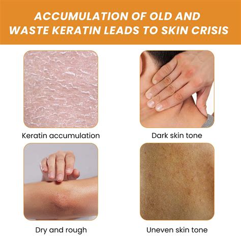 Jaysuing Exfoliating Whitening Gel Best Selling Deep Tone Moisturizing