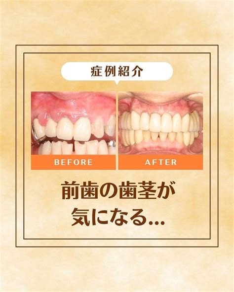 医療法人社団ケイ歯科クリニック 今回は審美歯科の種類の解説です。 審美歯科とは、文字の通り審美性を重視した歯科治療ですがケイ歯科クリニック