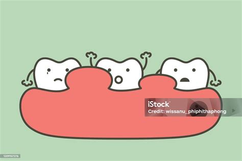 건강에 해로운 치아 때문에 치은염 또는 농양의 잇몸 질환 잇몸이 부어 종기 부상에 대한 스톡 벡터 아트 및 기타 이미지 종기