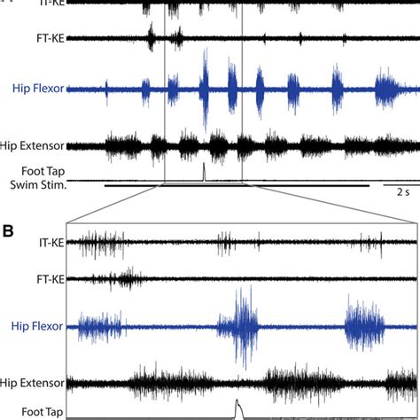 Example Of A Motor Pattern Evoked By A Foot Tap During The Hf Phase Of