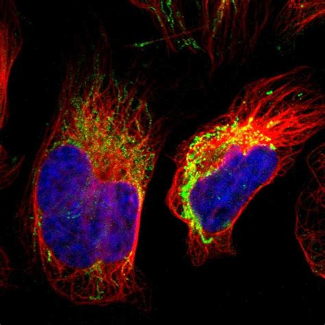Rabbit Polyclonal Anti S100a10 Antibody Buy For Research Highly