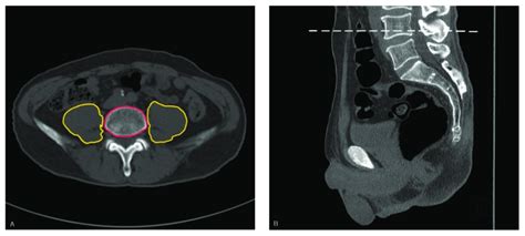 A Representative Cross Sectional Image Measurement Of The Right And