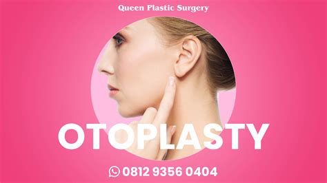 OTOPLASTY PROSEDUR OPERASI KOREKSI TELINGA Klinik Bedah Plastik Queen