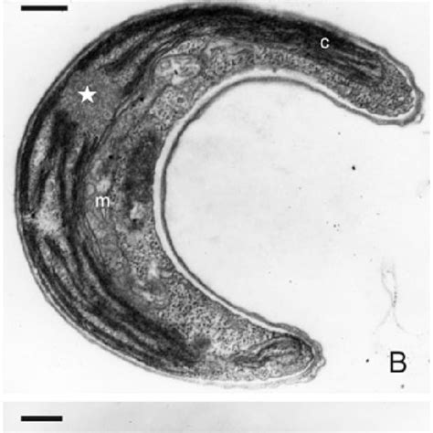 Lm And Tem Micrographs Of Raphidocelis Subcapitata In Culture Scale