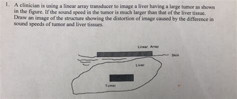 1 A Clinician Is Using A Linear Array Transducer To Chegg Com