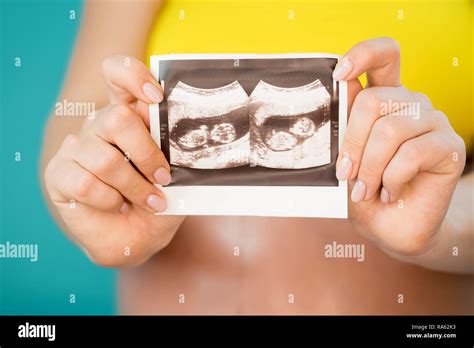 Close Up Of Unrecognizable Pregnant Woman Holding Ultrasound Scan On