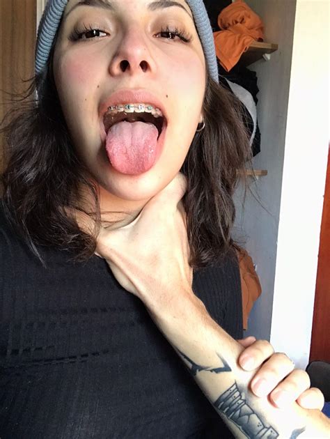 Do You Like My Blue And Pink Braces R BracesPorn