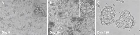 Phase Contrast Micrographs Of Cscs Derived From Stage Iiia Colon
