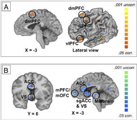Regions Active During Or Modulated By The Cognitive Regulation Of