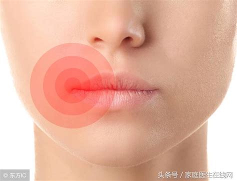 嘴唇經常乾裂起皮？不用多說，是沒躲過這3個「元兇」 每日頭條