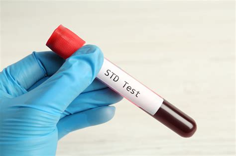 흰색 배경에 혈액 샘플과 라벨 Std 테스트가있는 튜브를 들고 과학자 클로즈업 Stem 주제에 대한 스톡 사진 및 기타 이미지