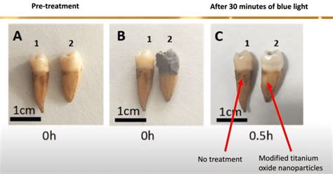 Researchers Develop New Coating That Could Remove Teeth Stains More Effectively
