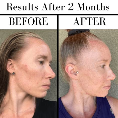 Beautycounter Vitamin C Serum Review Pure And Simple Nourishment