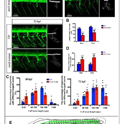 Primary Motor Neuron Morphogenesis Defects In The Sox2 Knockout Download Scientific Diagram